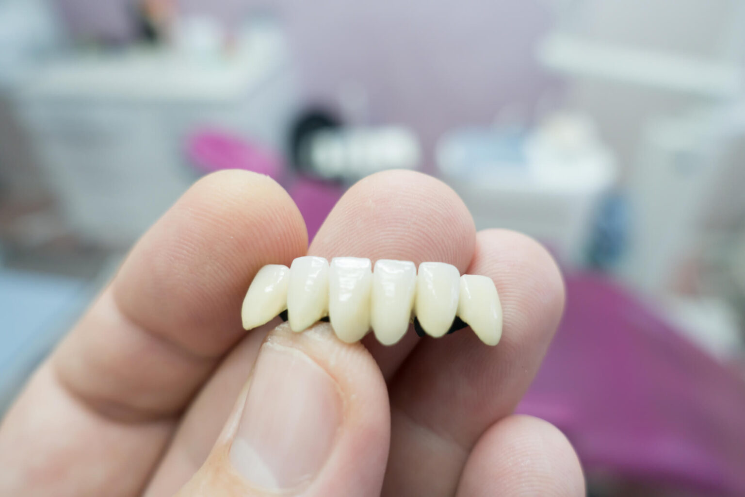 Do Porcelain Crowns Stain? - Baylee Dental